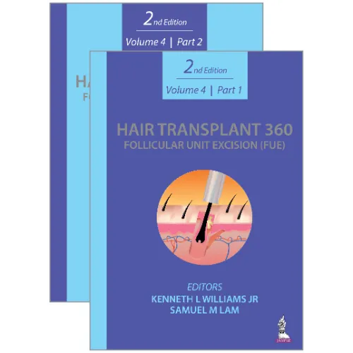 Hair Transplant 360: Follicular Unit Excision (FUE) By Editors: Kenneth ...